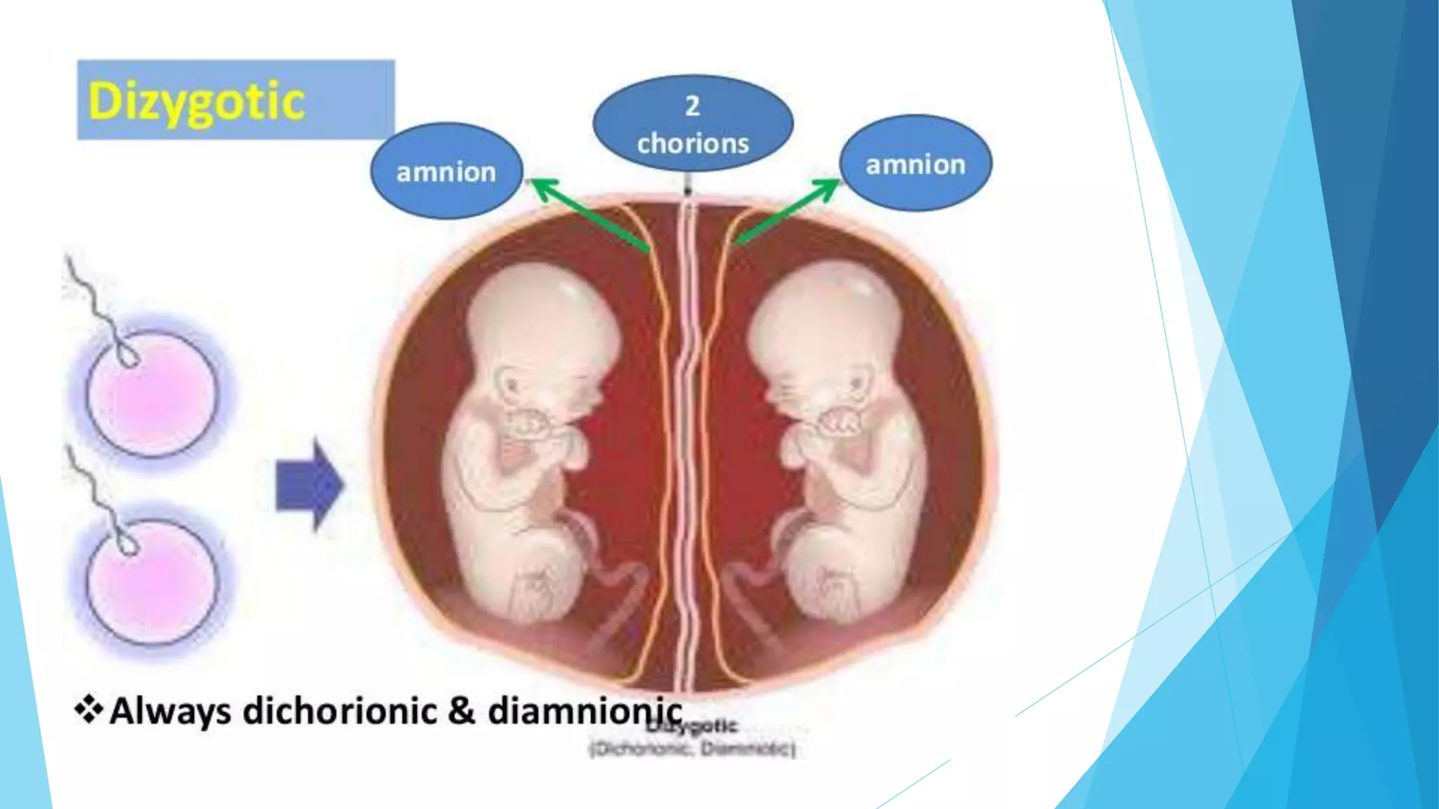 Twins (embryology) | PPTX