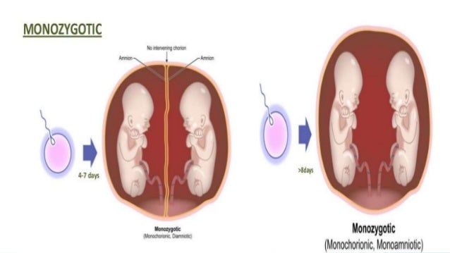 Twins Embryology