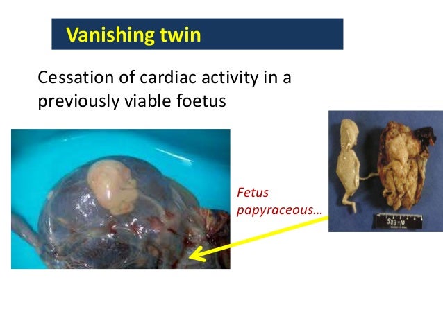 Twins for undergraduate