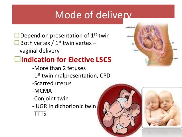 Twins for undergraduate