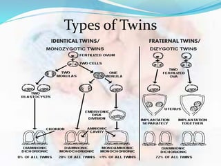 Twin study | PPTX