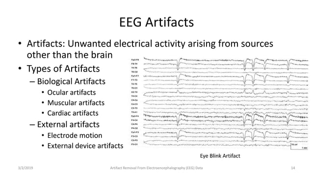 Two Algorithms for Weakly Supervised Denoising of EEG Data | PPT