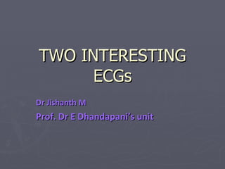 Two Interesting ECGs | PPT