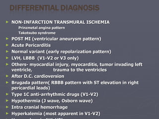 Two Interesting ECGs | PPT