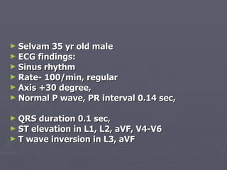 Two Interesting ECGs | PPT