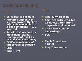 Two Interesting ECGs | PPT
