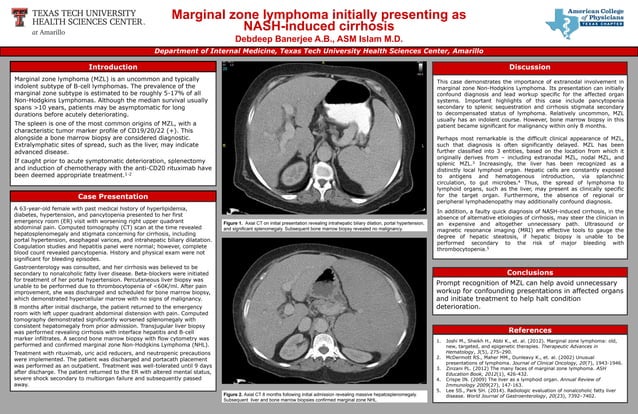 Texas chapter of the ACP annual meeting 2016 poster | PPTX | Blood ...