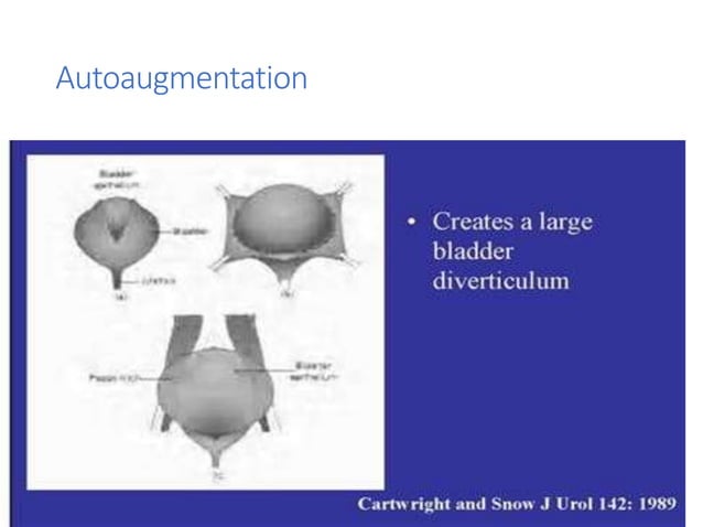TX in Abnormal bladder.pptx ghfdggoibgf ffghhj | PPTX | Digestive ...