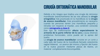 cirugía ortognática para tratamiento de ortodoncia | PPTX