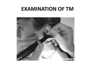 Tympanic membrane | PPTX