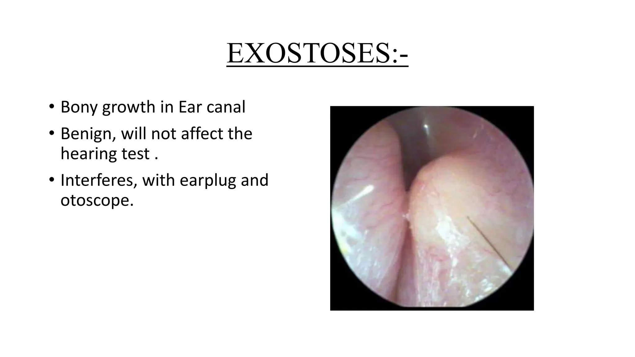 tympanic membrane.pptx