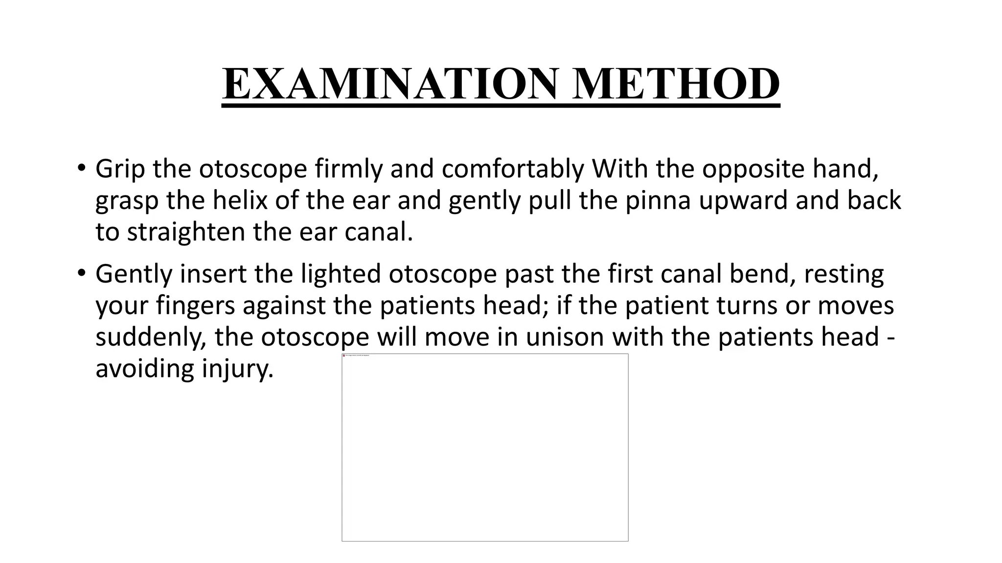 tympanic membrane.pptx