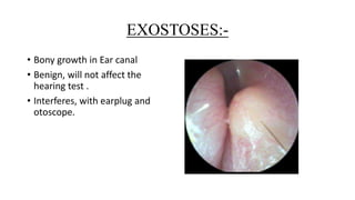 tympanic membrane.pptx