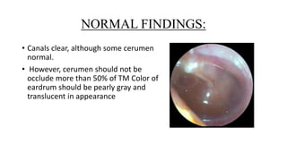 tympanic membrane.pptx