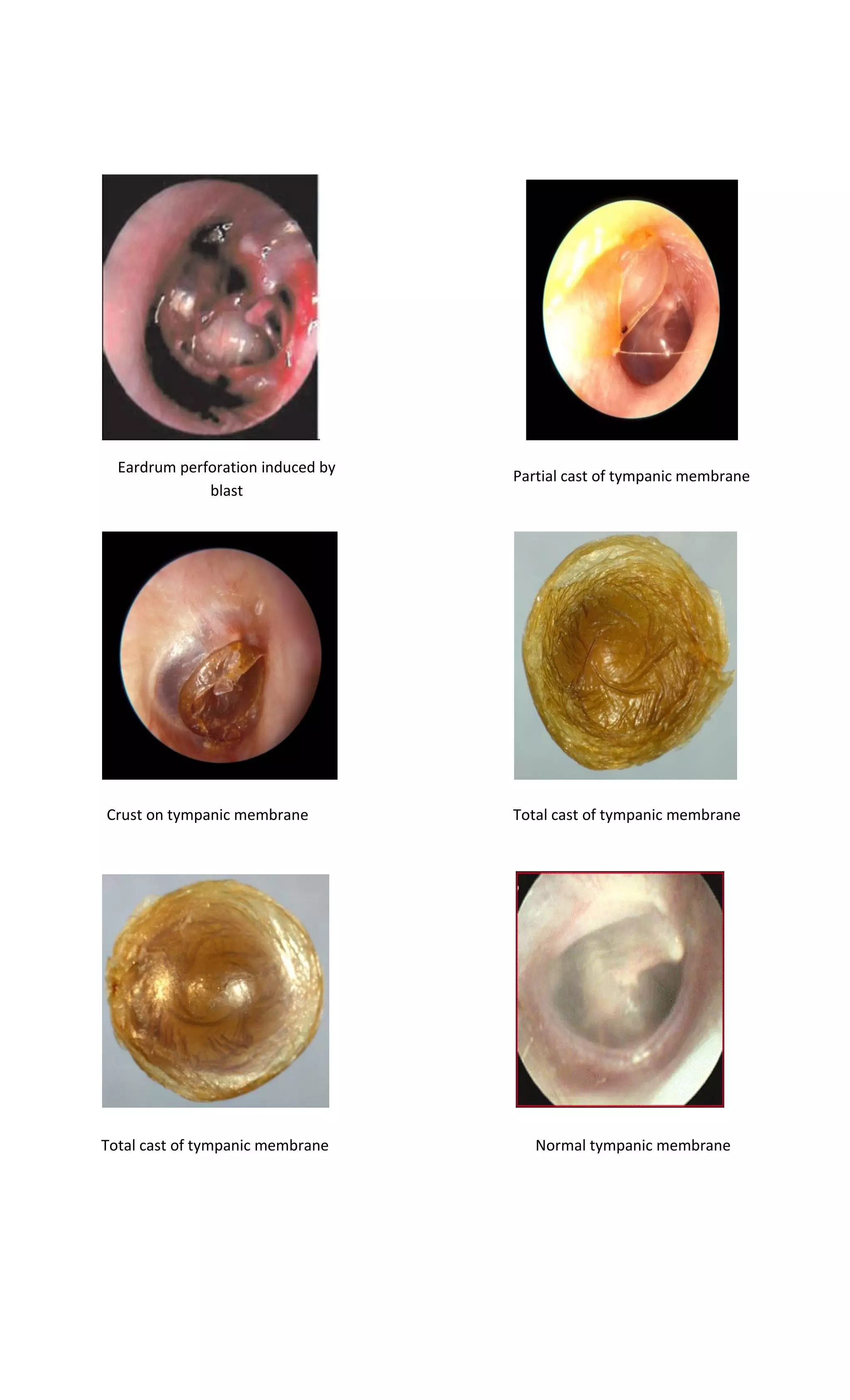 Tympanic membrane dr. fadil | PDF