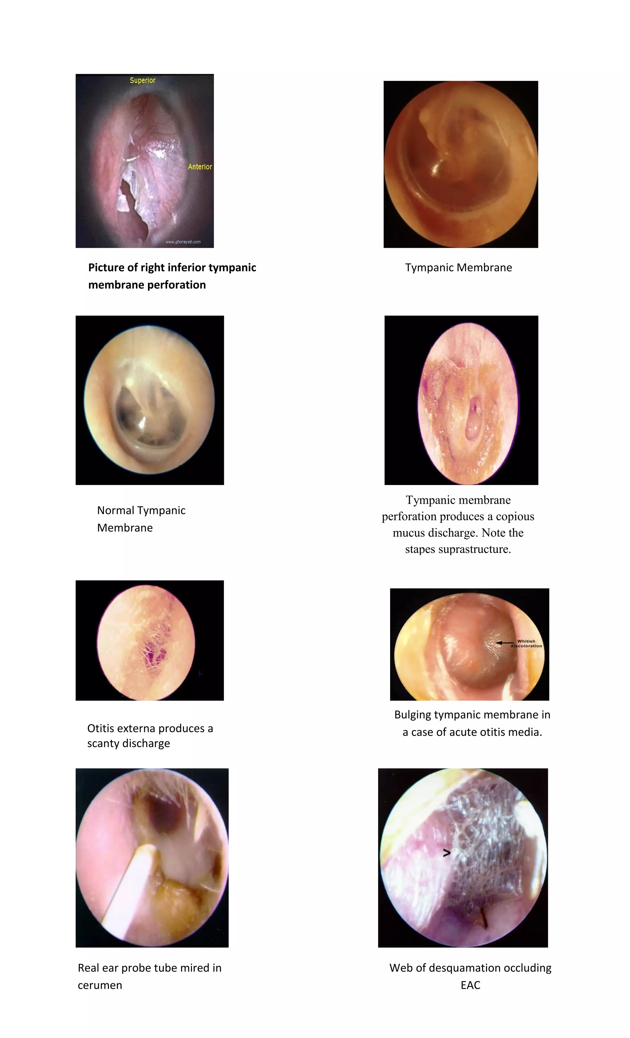 Tympanic membrane dr. fadil | PDF