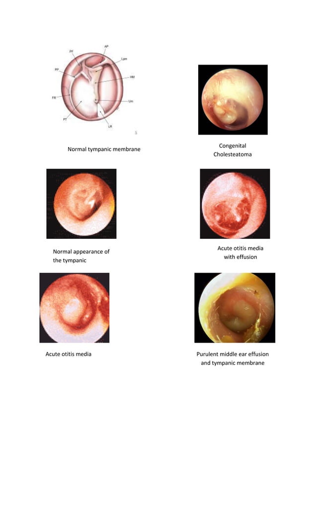 Tympanic membrane dr. fadil | PDF
