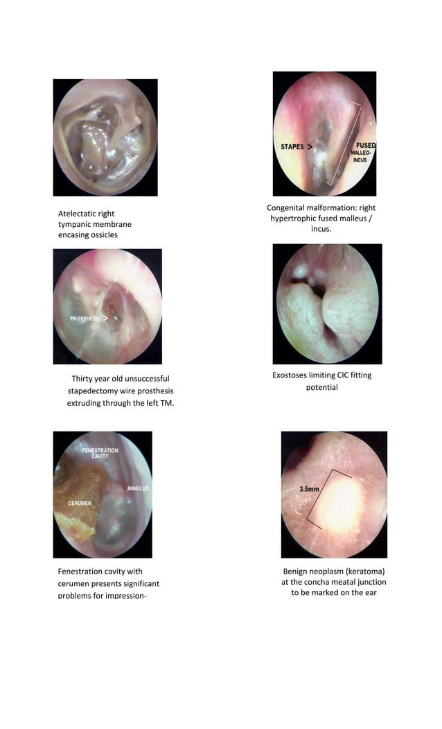 Tympanic membrane dr. fadil