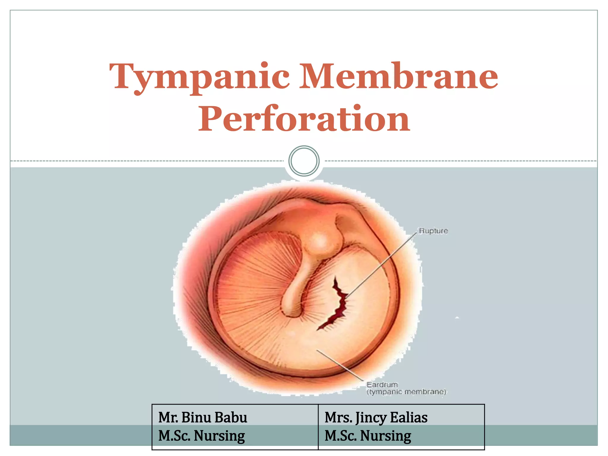 Tympanic membrane perforation | PPTX