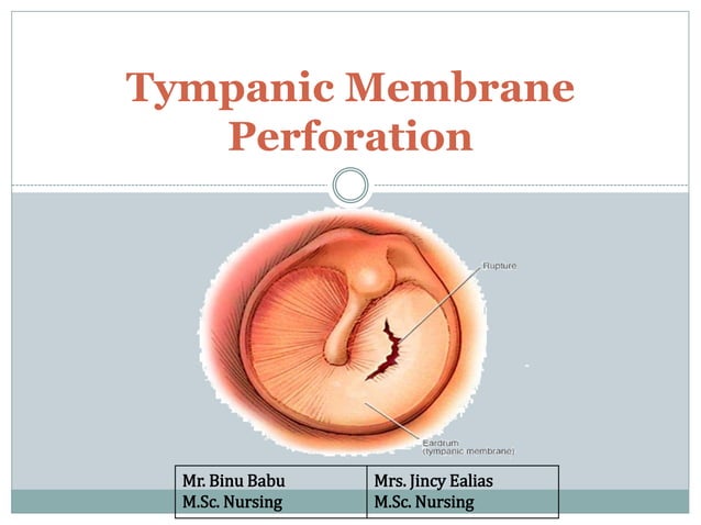 Tympanic membrane perforation