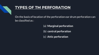 Tympanic membrane perforation.pptx