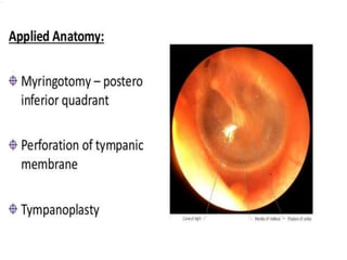 Tympanic Membrane ppt.pptx | Ear, Nose and Throat Conditions | Diseases ...