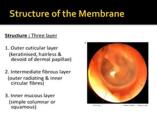 Tympanic Membrane ppt.pptx | Ear, Nose and Throat Conditions | Diseases and Conditions