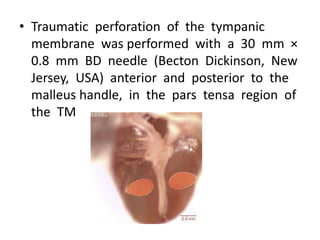 Tympanic perforation sponaneuos healing | PPTX