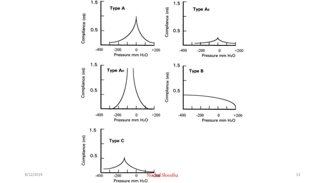 Tympanometry | PPTX