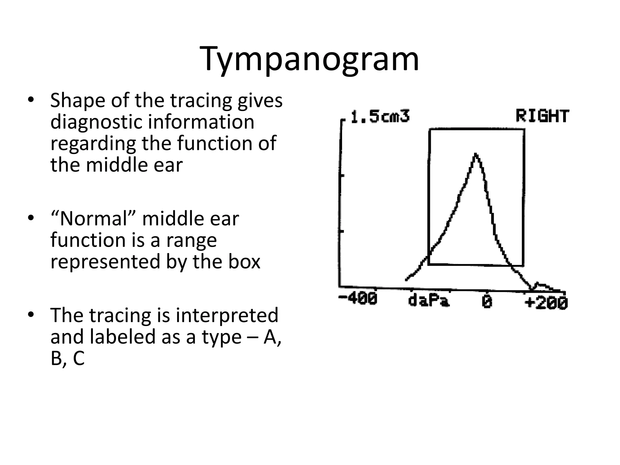 Tympanometry | PPTX
