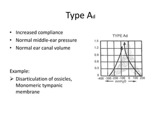 Tympanometry | PPTX