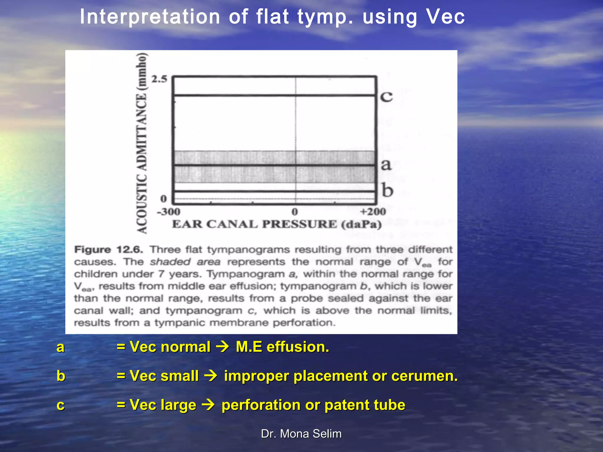 Tympanometry & Clinical Applications | PPT