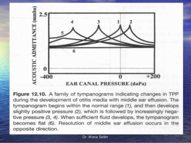 Tympanometry & Clinical Applications