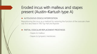 Tympanoplasty and ossiculoplasty | PPT