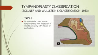 Tympanoplasty and ossiculoplasty | PPT
