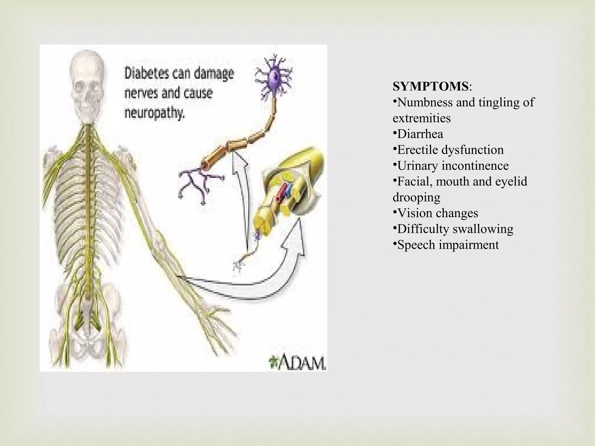 Case on type II diabetes mellitus with peripheral neuropathy with ...