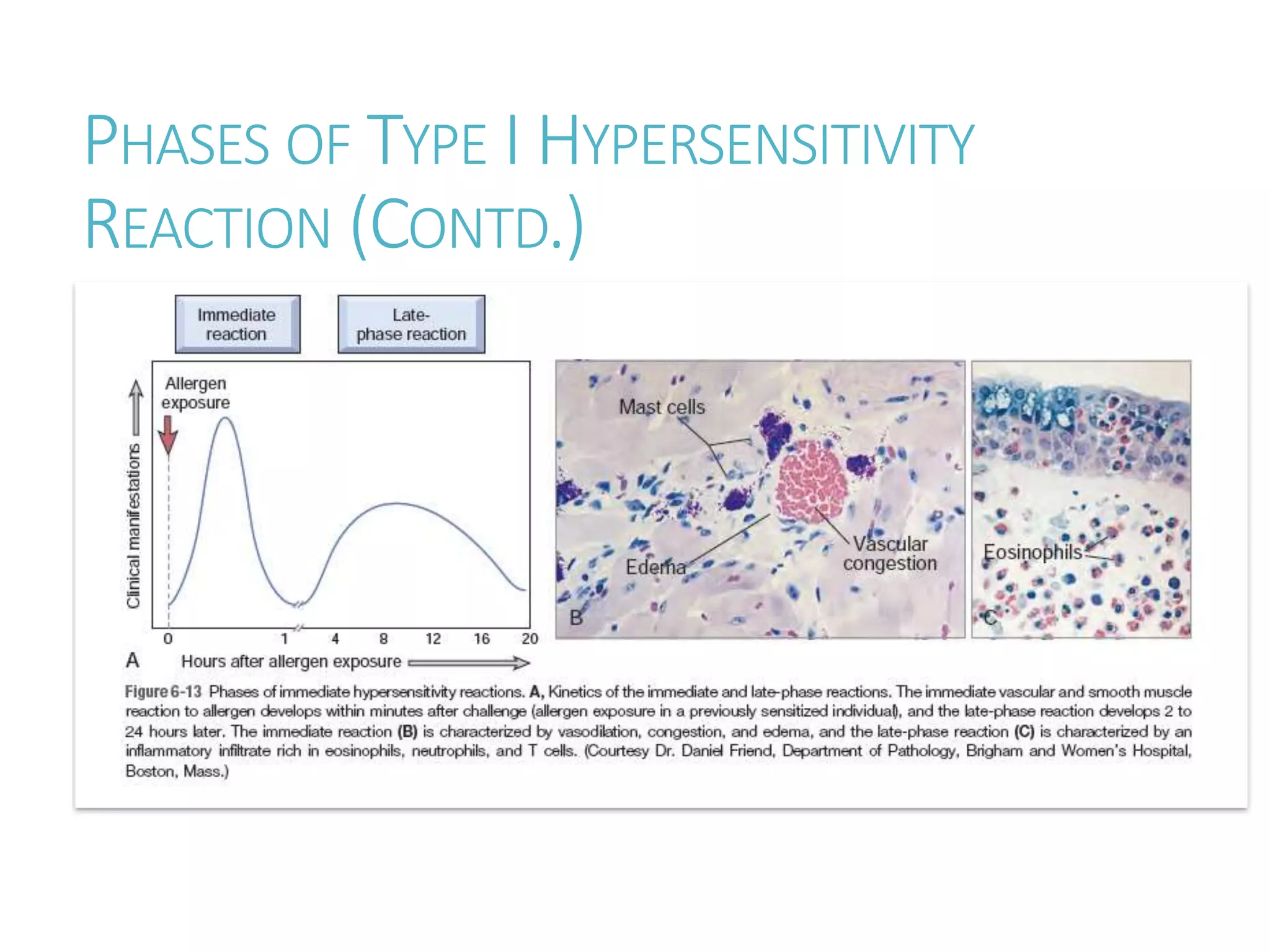 Type I Hypersensitivity Reaction | PPTX