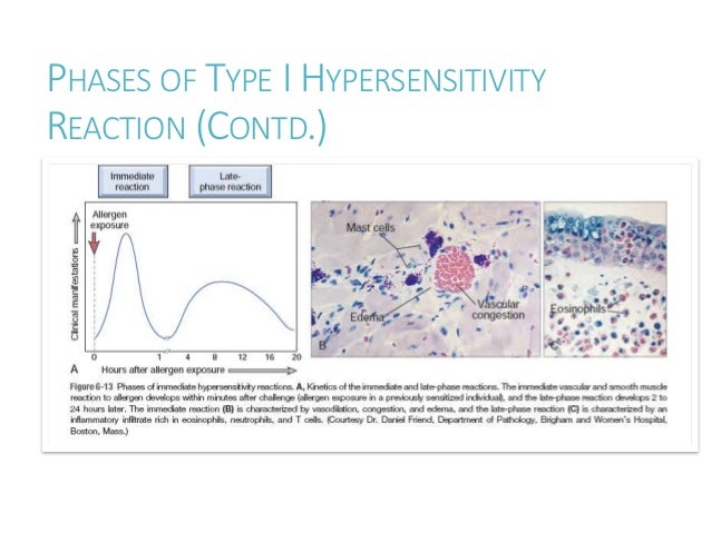 Type I Hypersensitivity Reaction