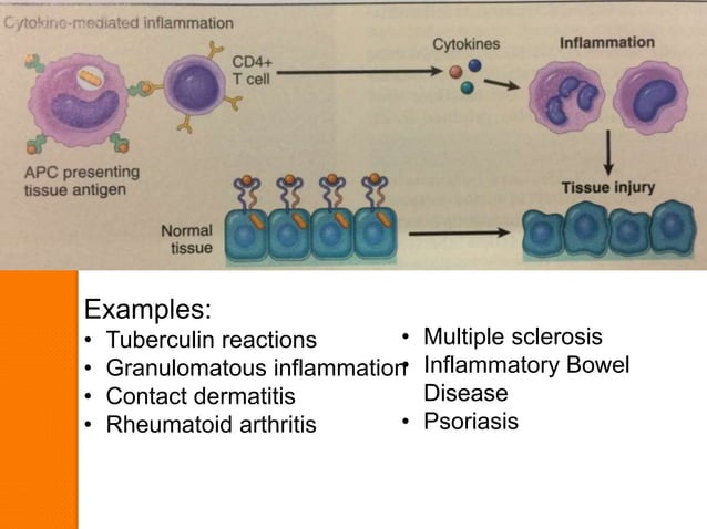 Type iv hypersensitivity reaction | PPTX