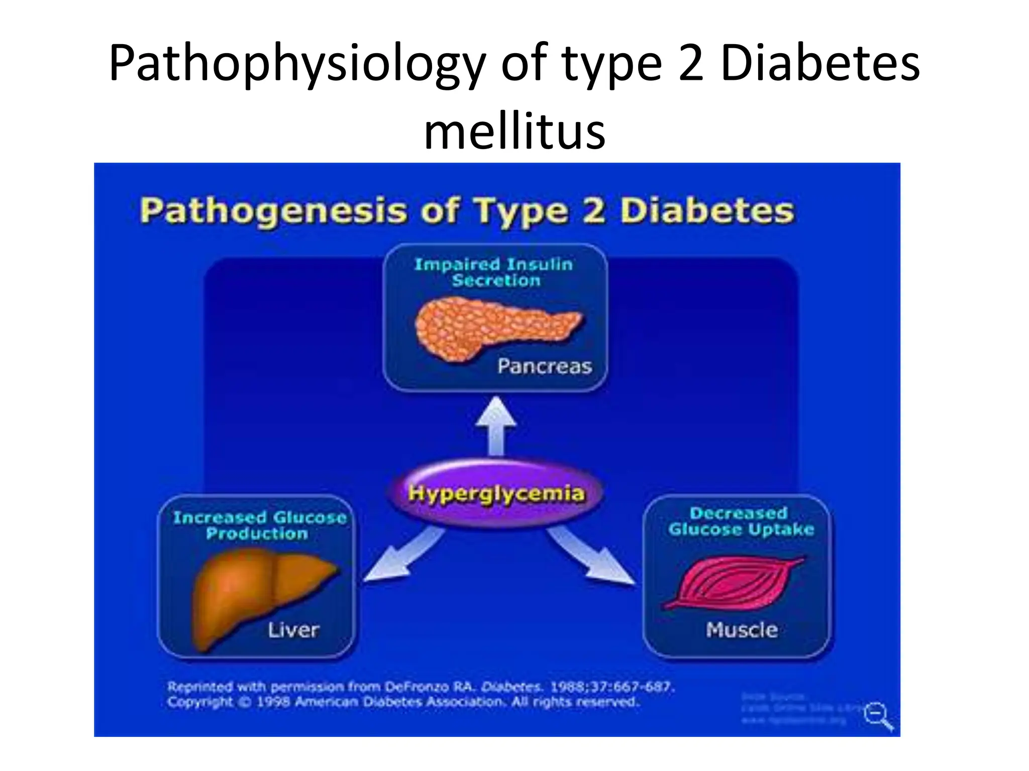 Type 1 Diabetes and Insulin UG Classes.pptx