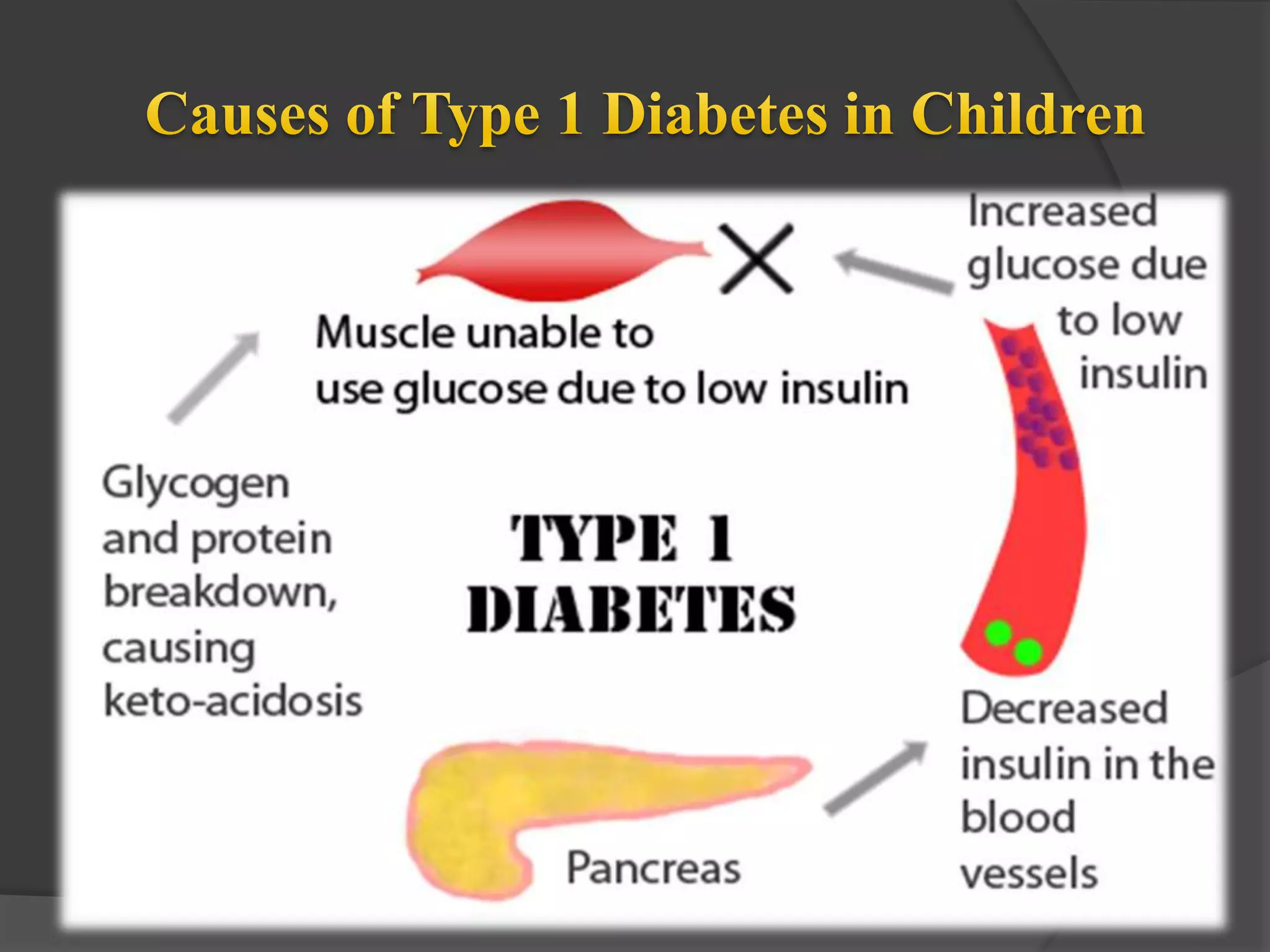Type 1 diabetes in children | PPTX