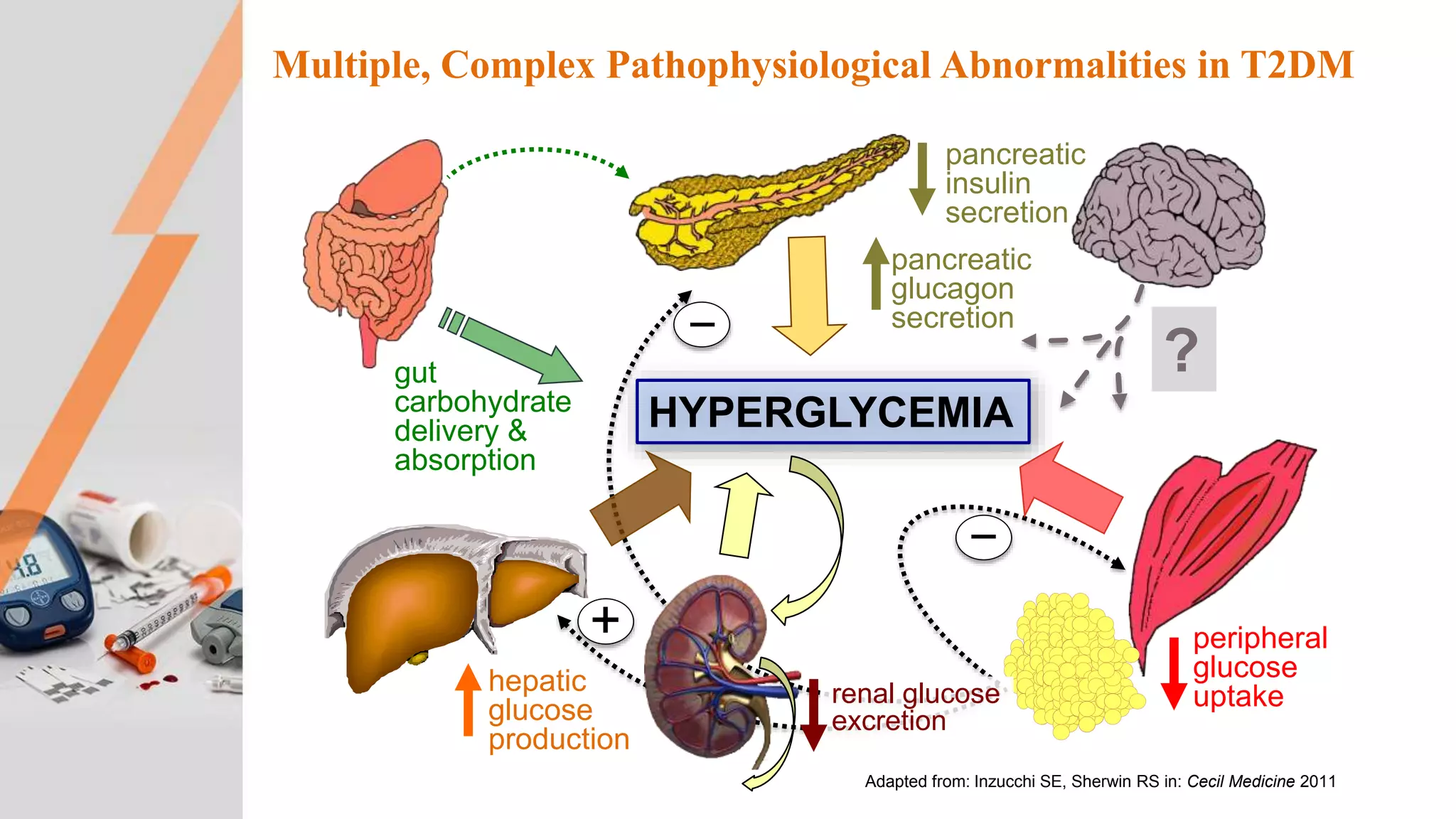 Type 2 diabetes pathogenesis | PPTX