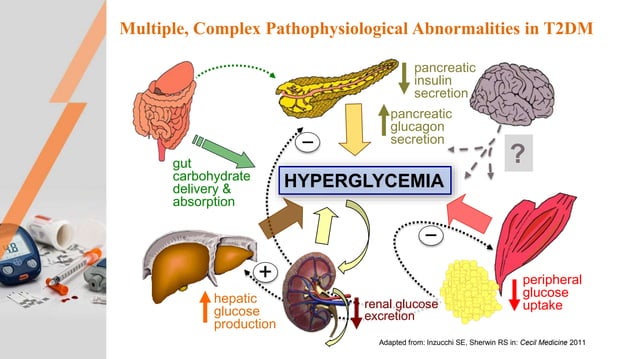 Type 2 diabetes pathogenesis | PPTX | Endocrine and Metabolic Diseases ...