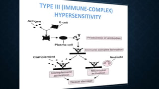 hypersensitivity reactions type 3 and 4 | PPTX
