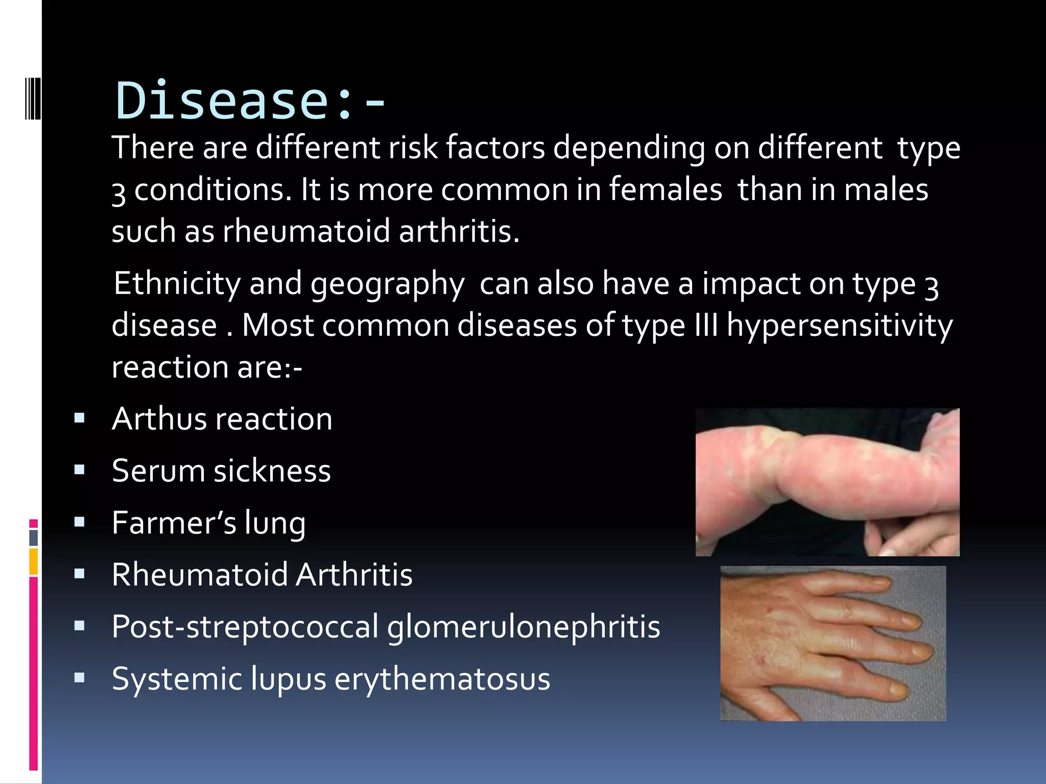 Type 3 hypersensitivity 1728.pptx
