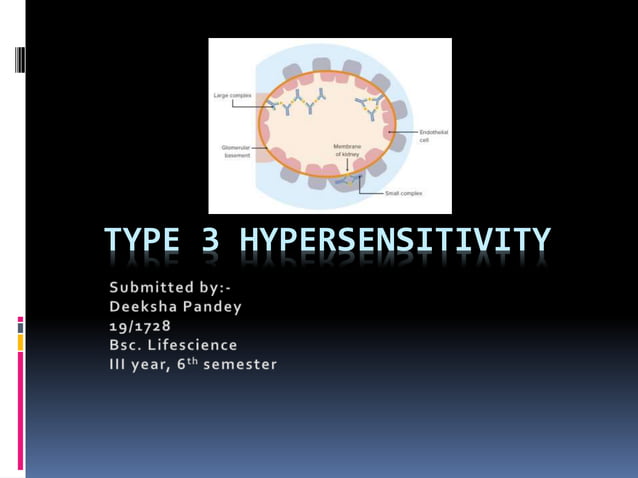 Type 3 hypersensitivity 1728.pptx
