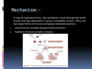 Type 3 hypersensitivity 1728.pptx