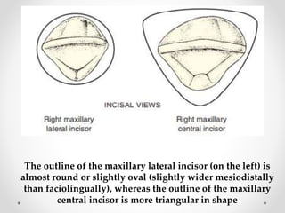 TYPE and Arch TRAITS OF InNCISORS.pptx