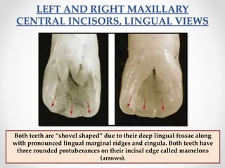 TYPE and Arch TRAITS OF InNCISORS.pptx