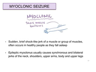 Type and evaluation of seizures | PPT